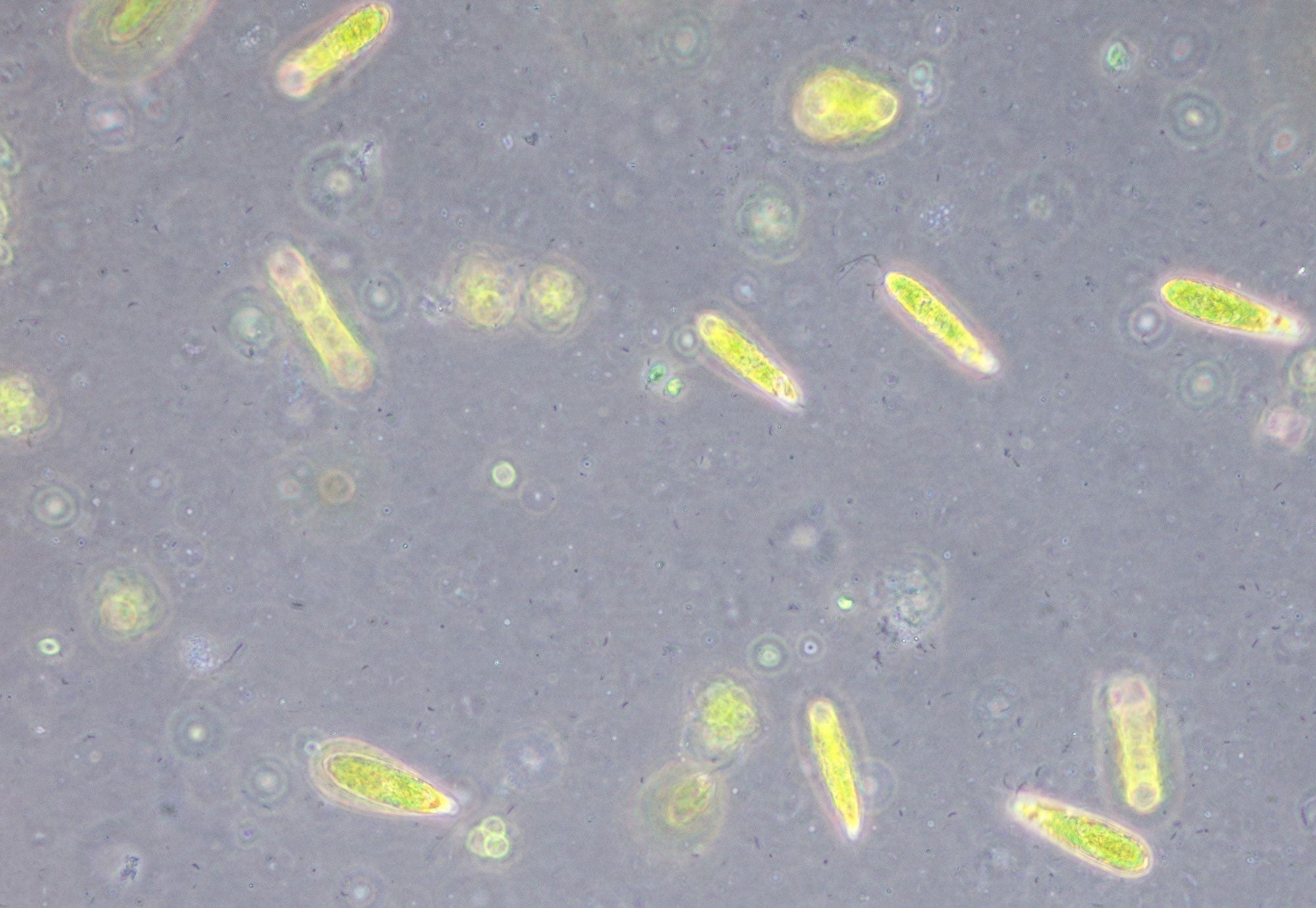 Bacteria under the microscope: a closer look — Microscopes.com.au