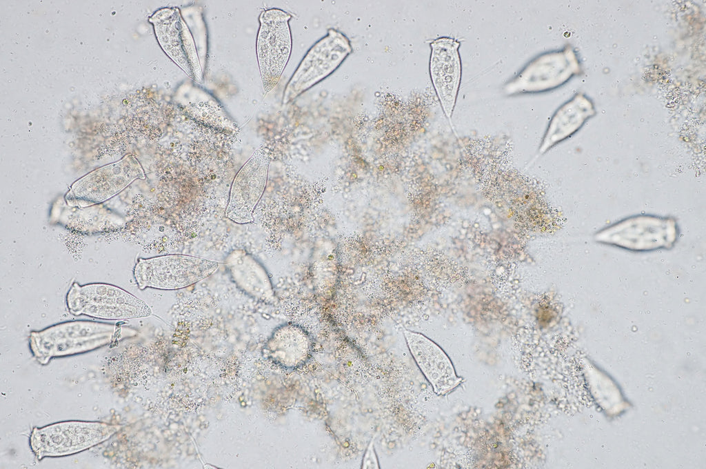 Choosing the best microscope for wastewater treatment — Microscopes.com.au