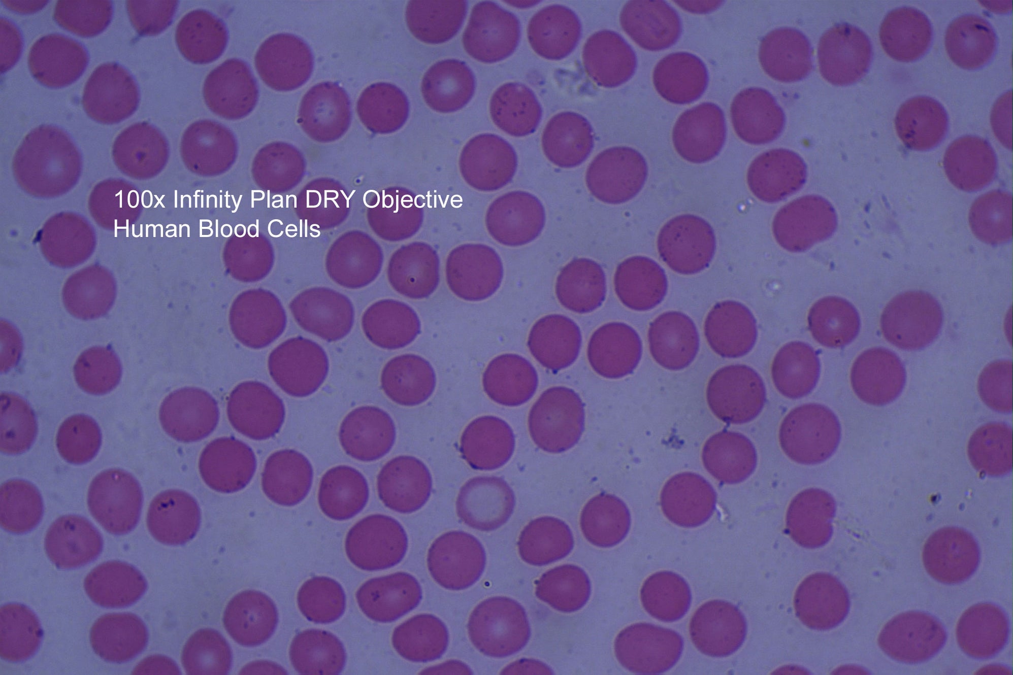 BM2000 With 100X DRY Objective - NEVER Use OIL Again — Microscopes.com.au