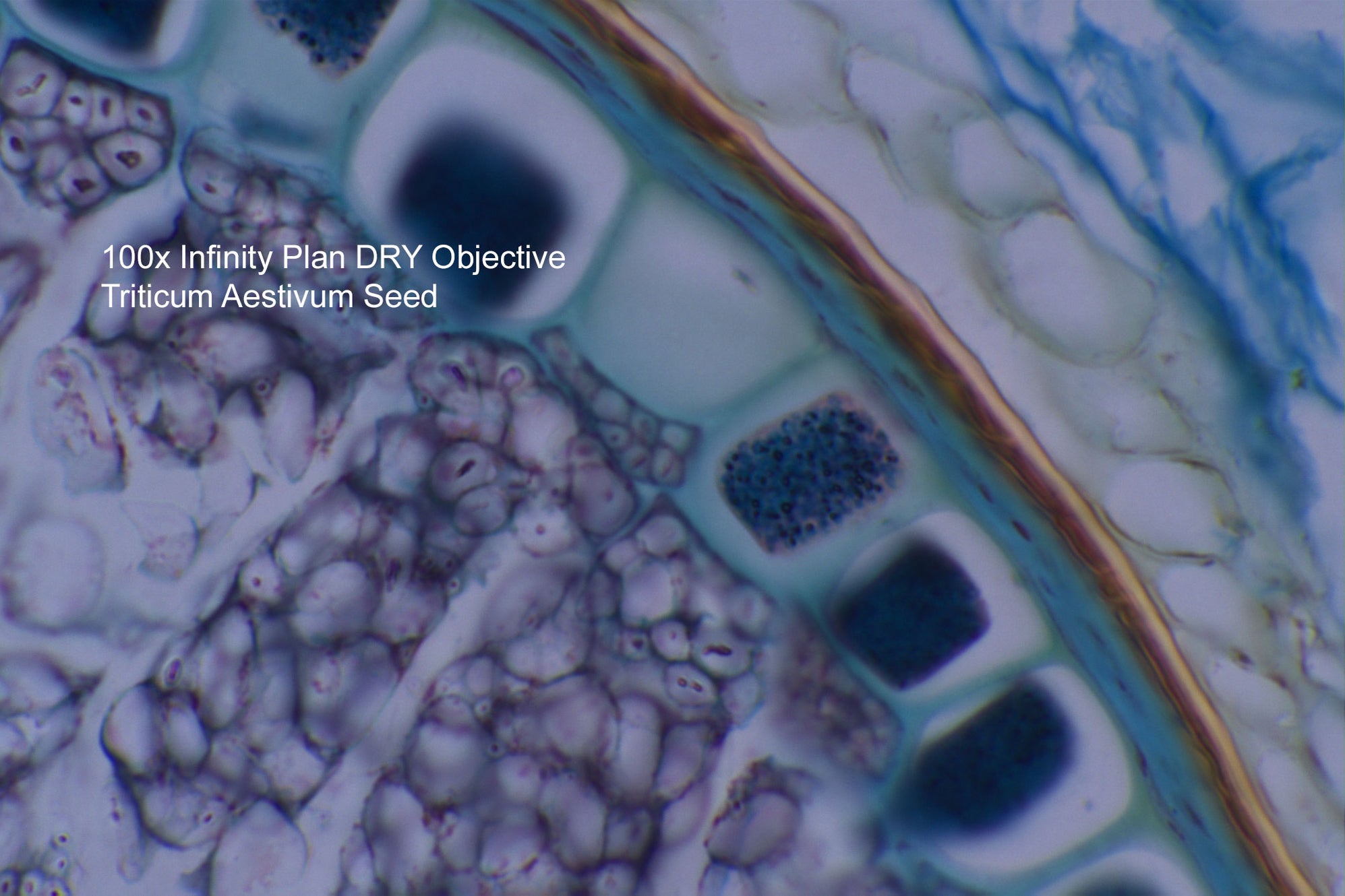 BM2000 With 100X DRY Objective - NEVER Use OIL Again — Microscopes.com.au