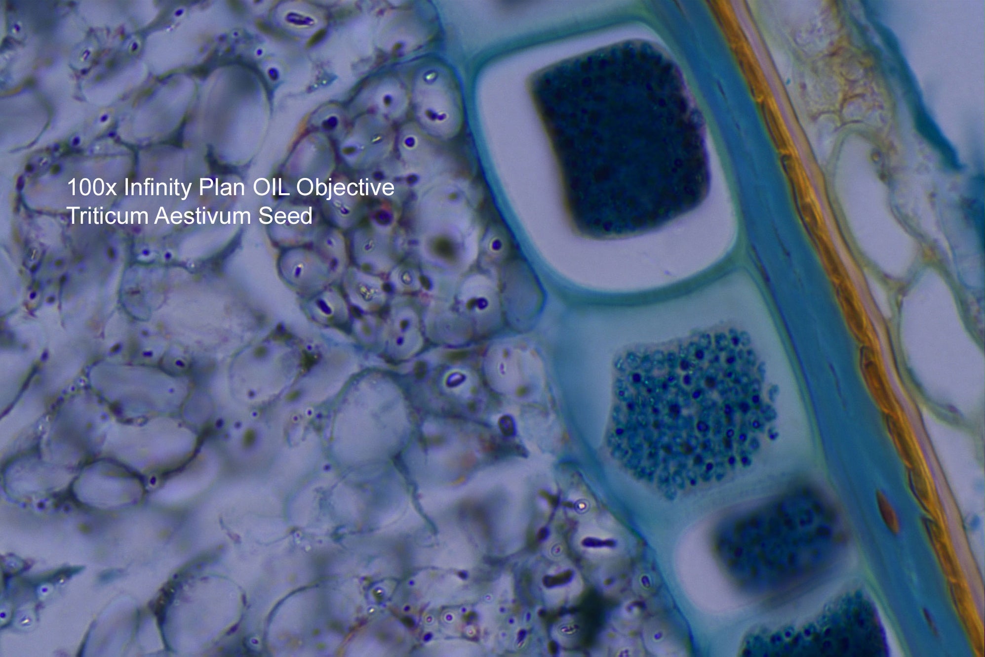 BM2000 With 100X DRY Objective - NEVER Use OIL Again — Microscopes.com.au