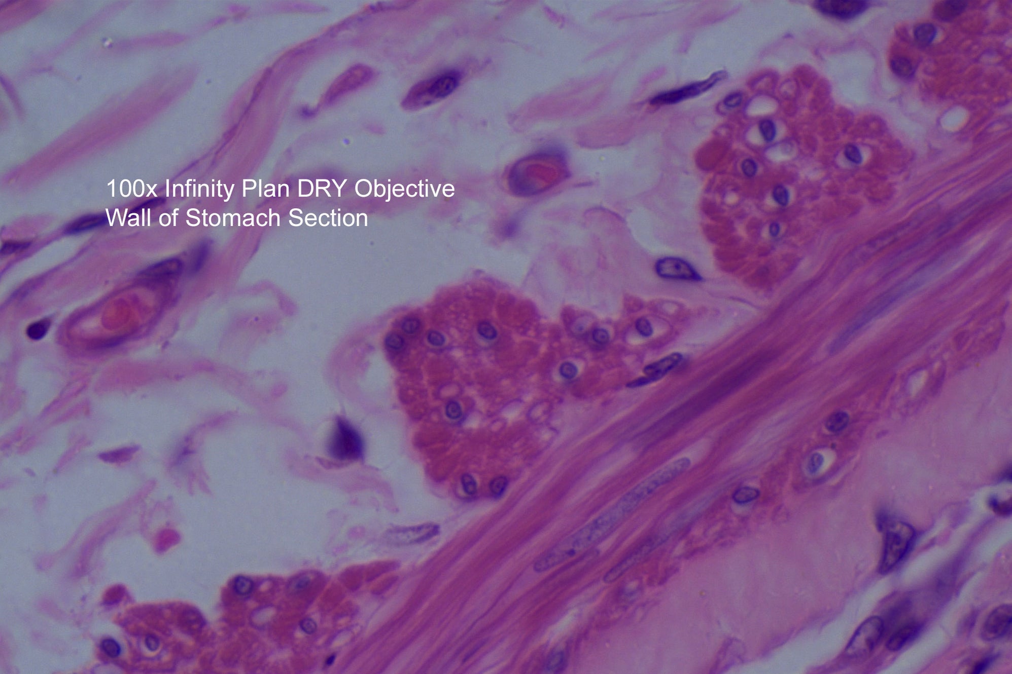 BM2000 With 100X DRY Objective - NEVER Use OIL Again — Microscopes.com.au