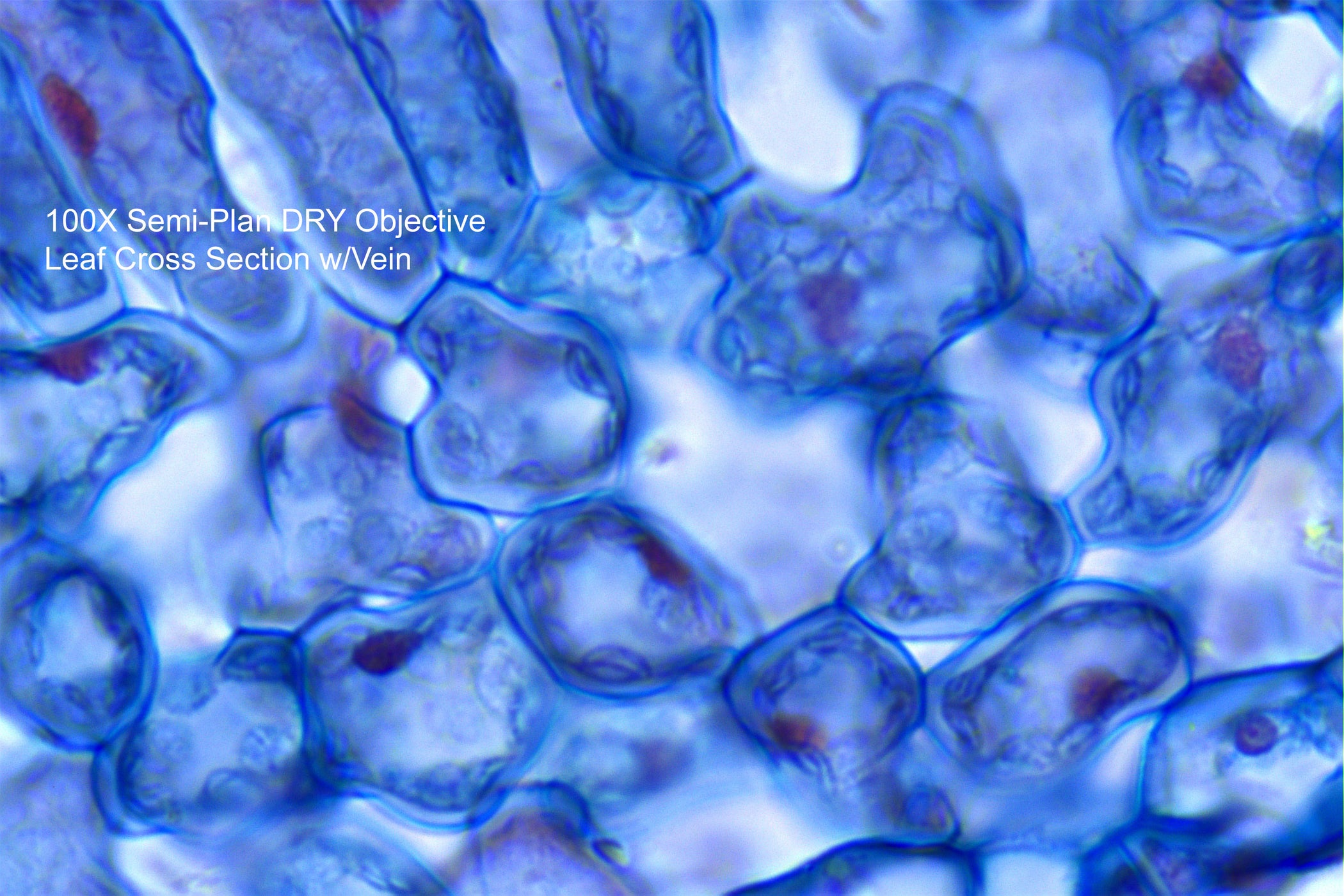 N120MT-SP With 100X DRY Objective - NEVER Use OIL Again — Microscopes ...