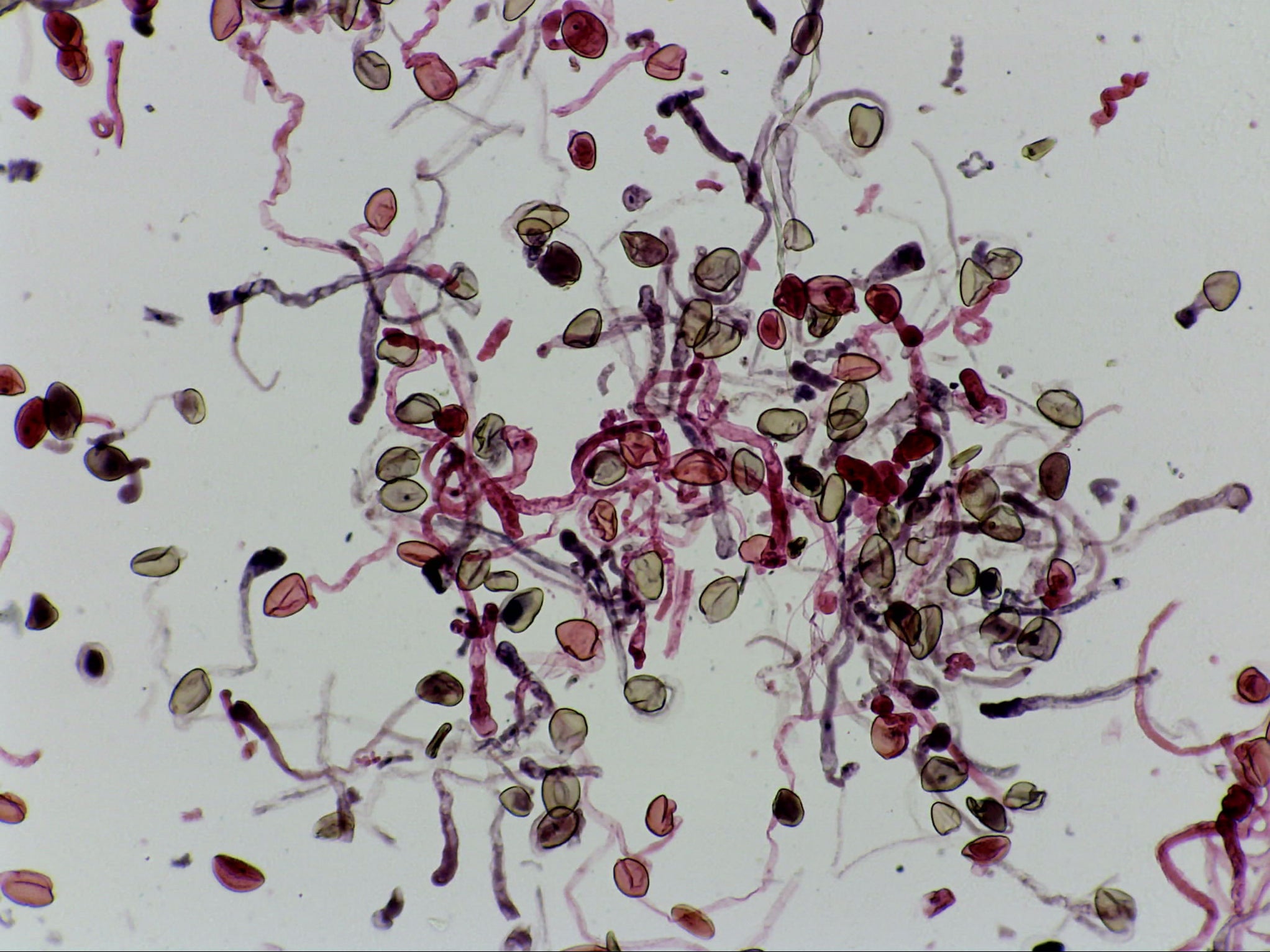 Dino-Eye Edge AM7025X — Microscopes.com.au