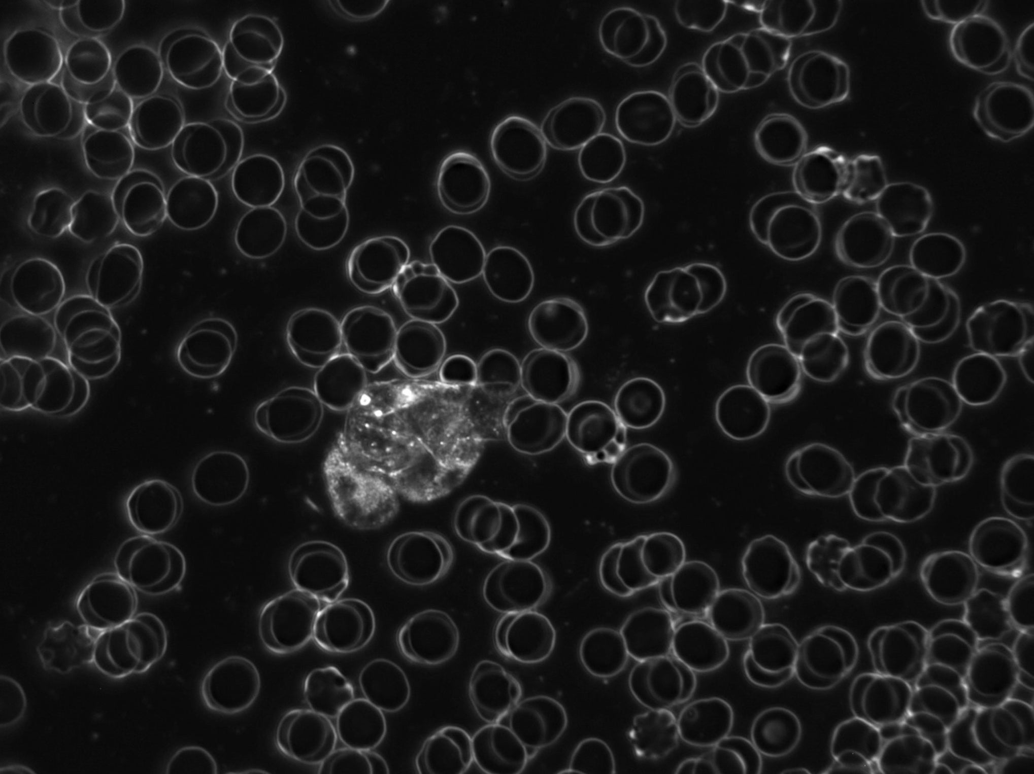 100X OIL IMMERSION DARKFIELD OBJECTIVE — Microscopes.com.au