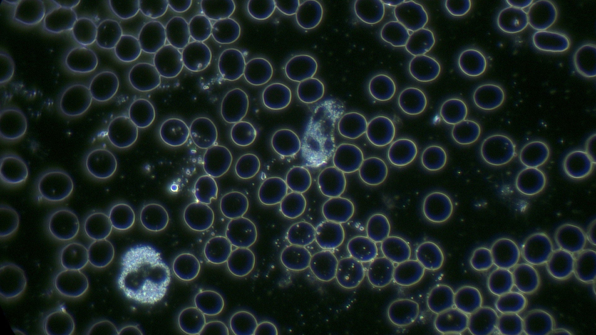 100X OIL IMMERSION DARKFIELD OBJECTIVE — Microscopes.com.au